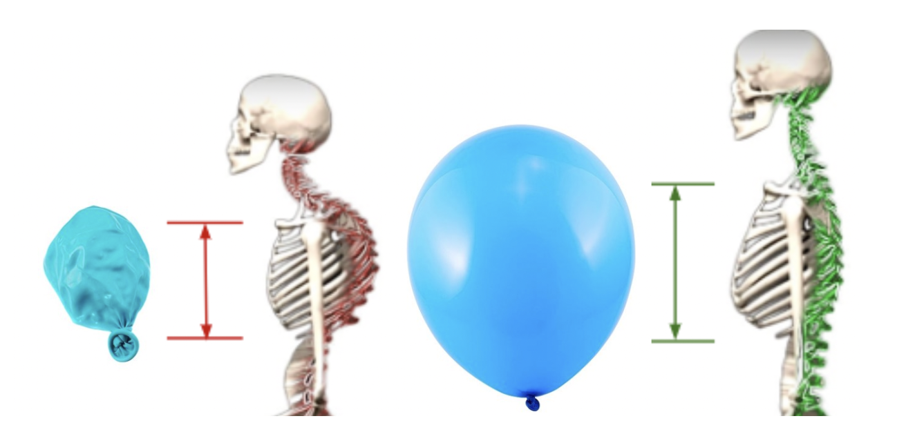 5 Ways Poor Posture Impacts Your Health, and How to Improve It ...